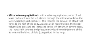 Heart Valves Disease (Mitral valve stenosis, Pumonary valve stenosis ...