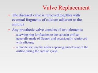 Heart valve surgery.pptx