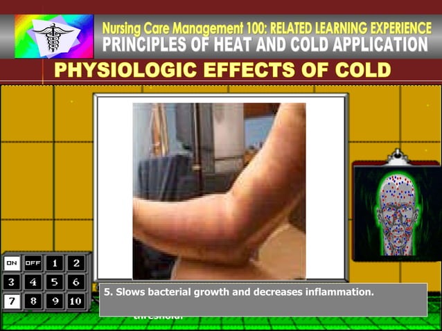 Heat and cold | PPT | First Aid | Injuries