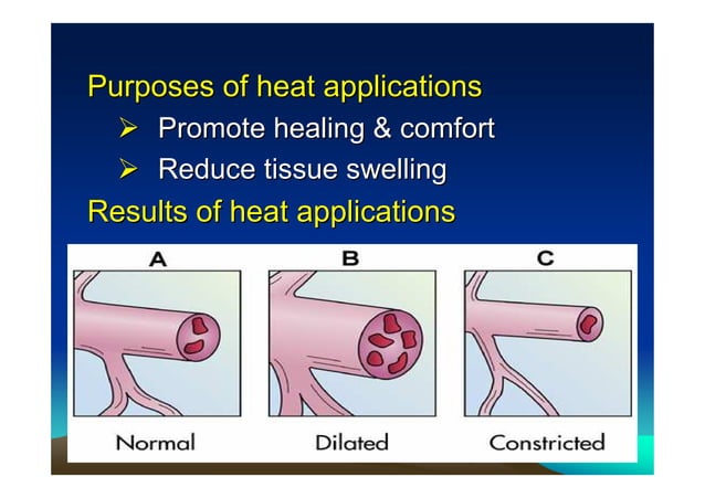 Heat and cold_application2012 | PPT