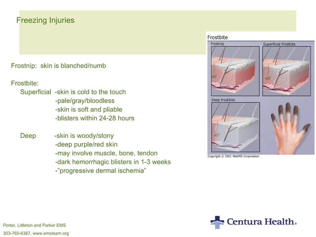 Heat And Cold Emergencies for EMS | PPT | Medical Health