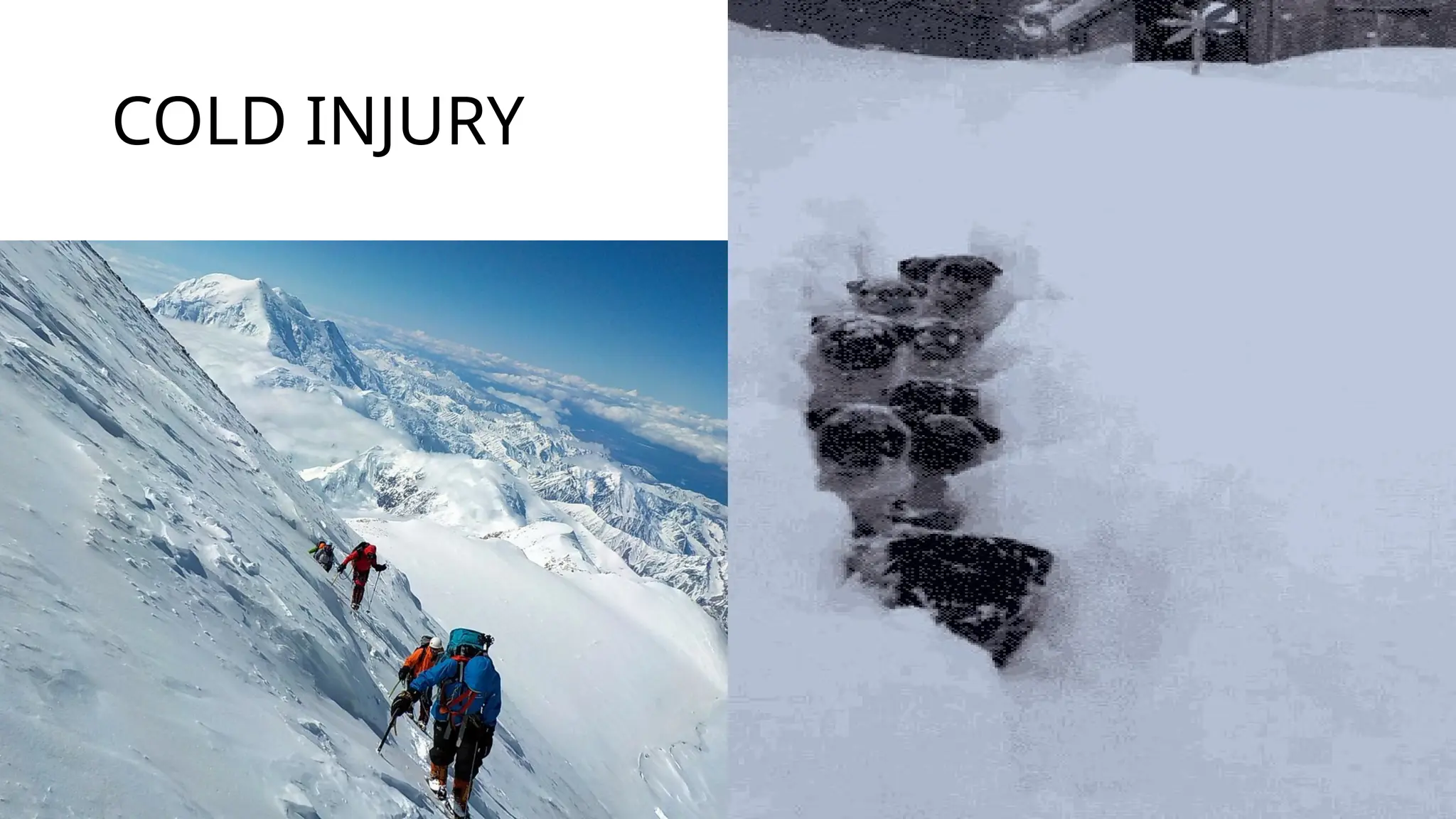 medical ijuries heat and cold injury.pptx