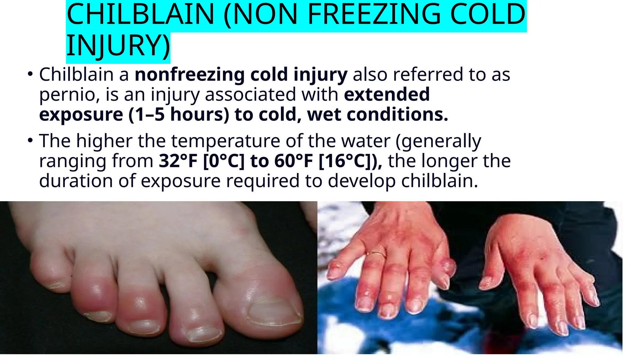 medical ijuries heat and cold injury.pptx