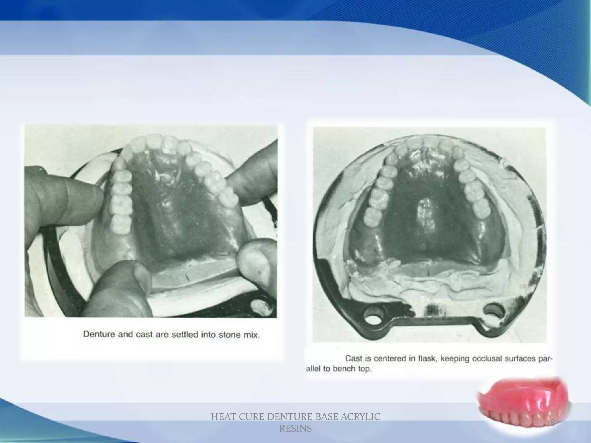 Heat cure acrylic | PPTX
