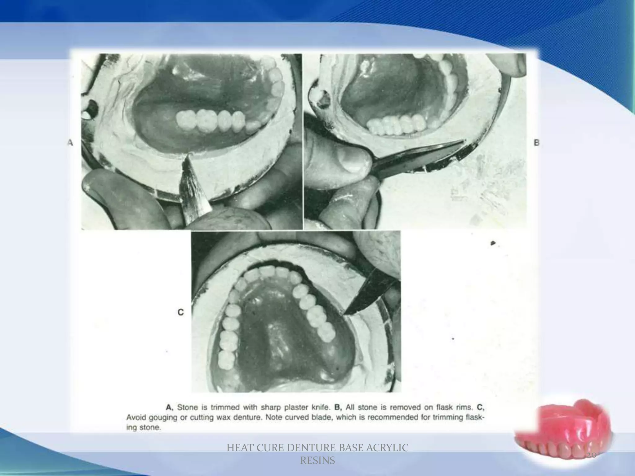 Heat cure acrylic | PPTX