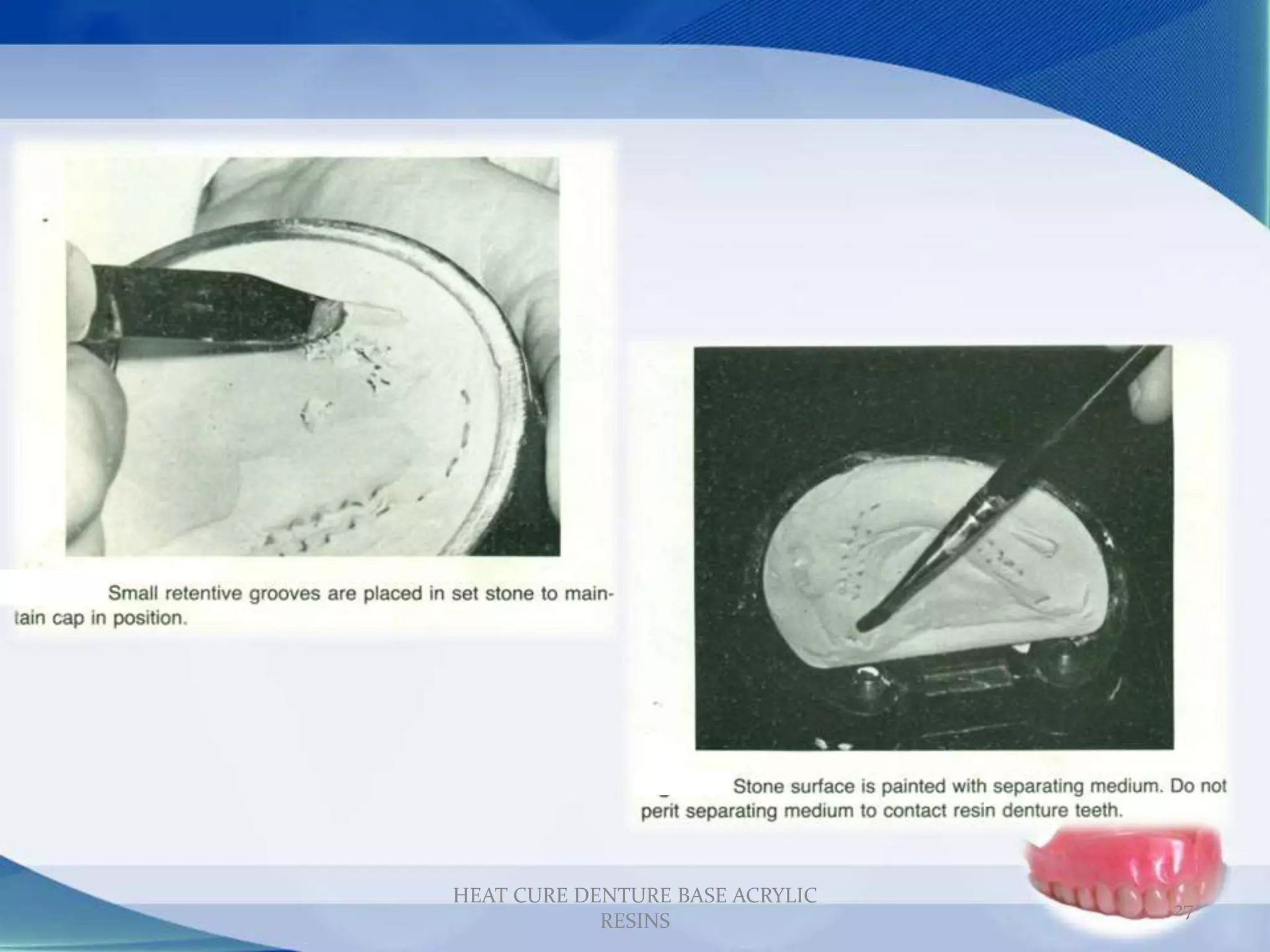 Heat cure acrylic | PPTX