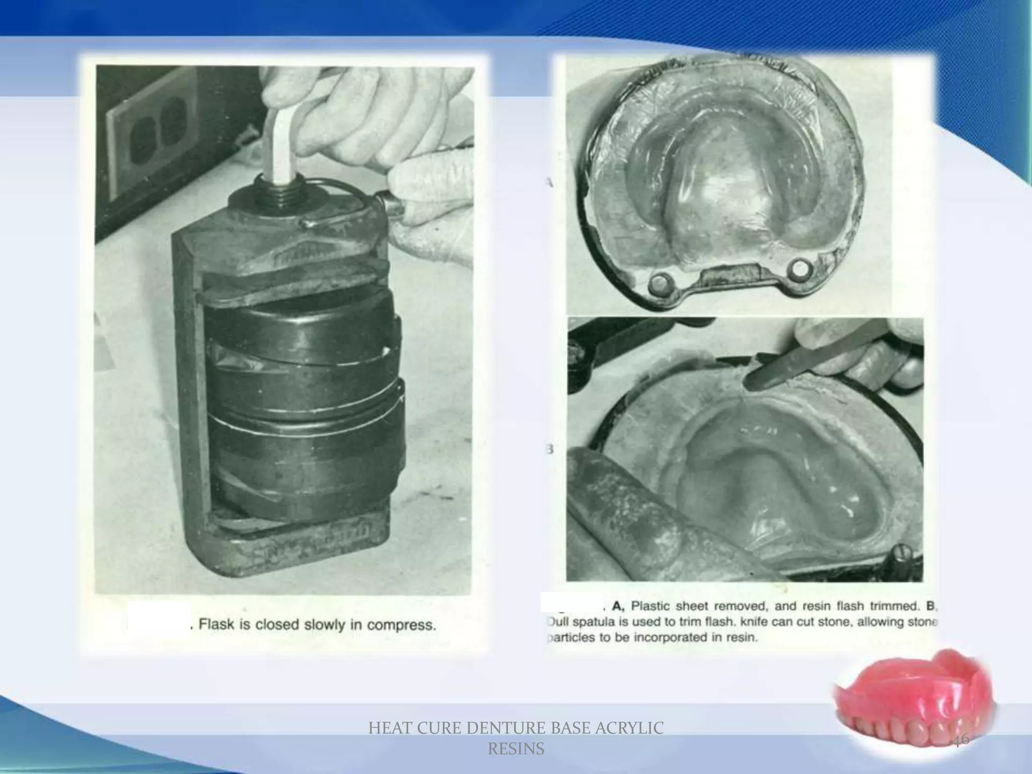 Heat cure acrylic | PPTX