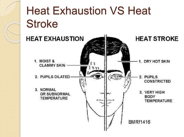 Heat exhaustion........................... | PPT