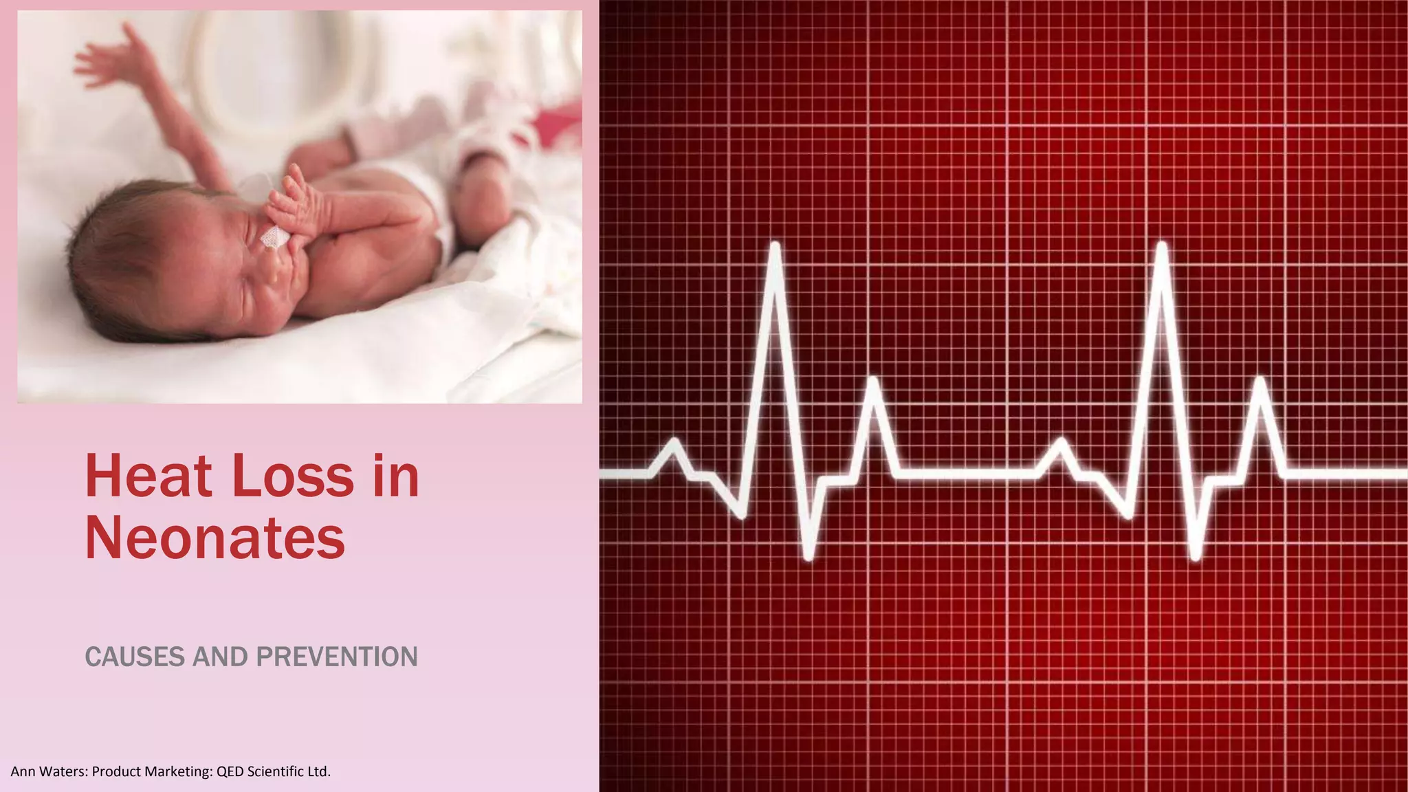 Heat Loss Prevention in Neonates | PPTX