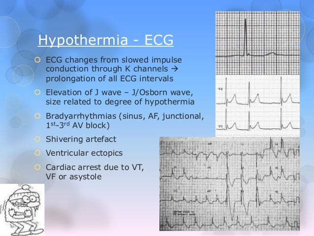 Heat related illness
