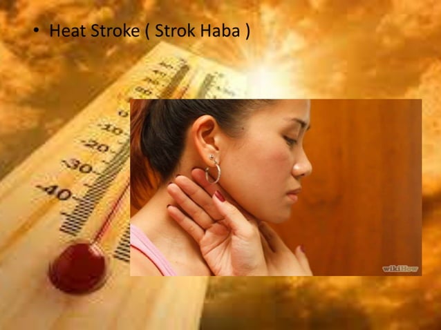 Heat stress ( Stres Haba ) | PPTX