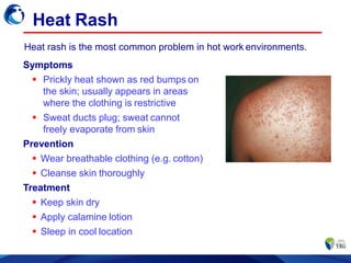 -- Heat Stress -- Training PPT | PDF