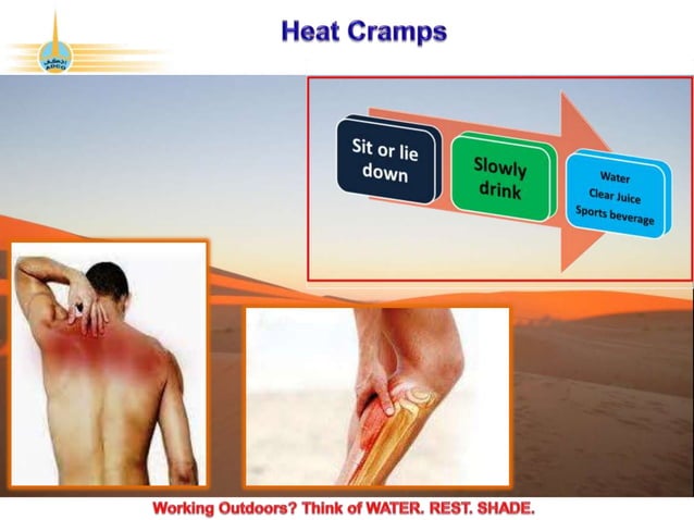 HEAT STRESS PRESENTATION - 2017.pptx | Skin and Dermatology | Diseases ...
