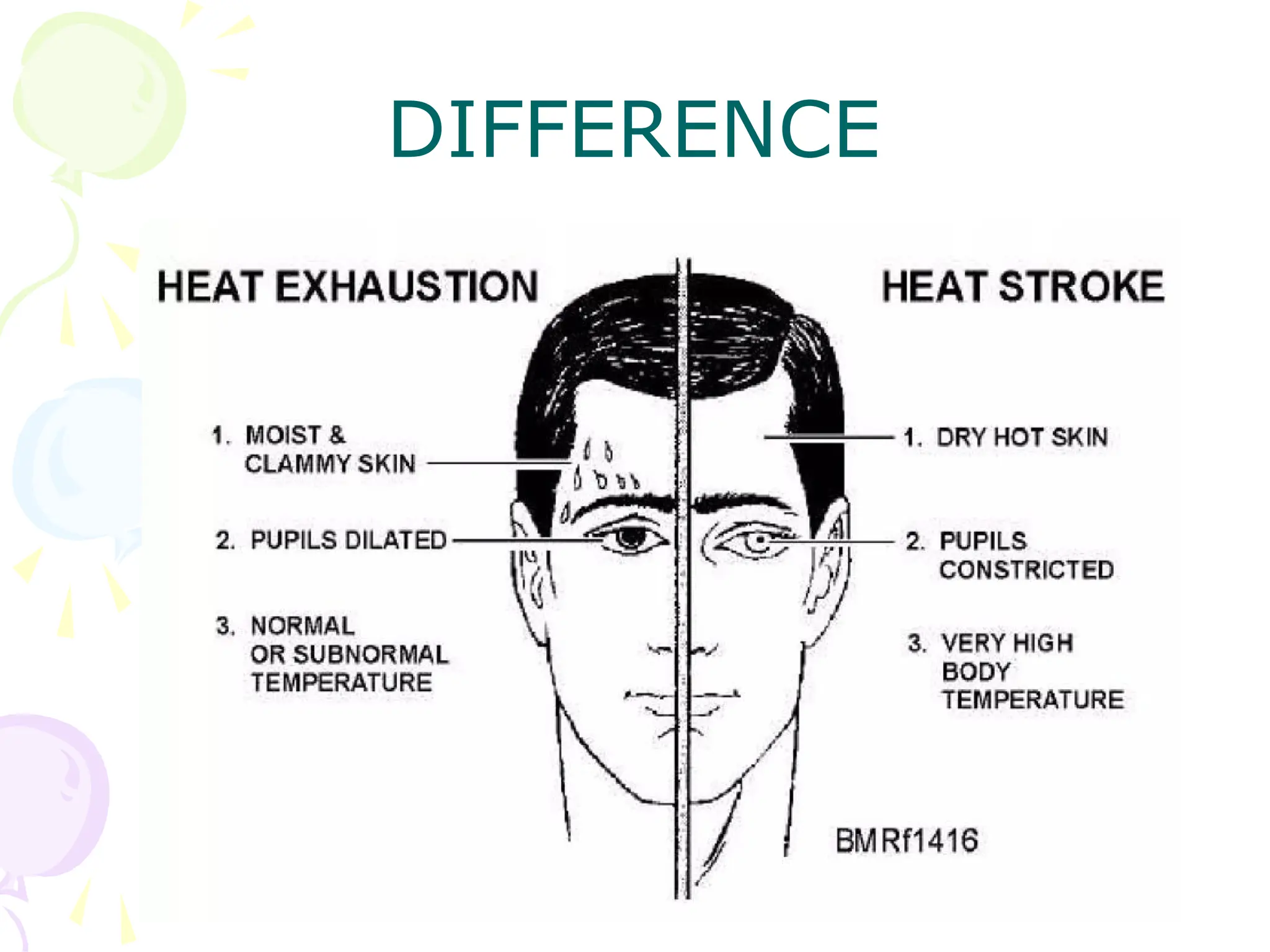 heat stroke also known as sun stroke or Hyperthermia | PPTX