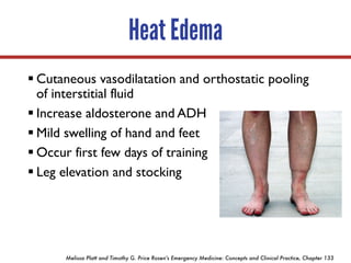 Heat stroke and rhabdomyolysis 2017 final | PDF
