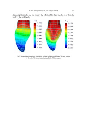 Heat transfer in human tooth | PDF