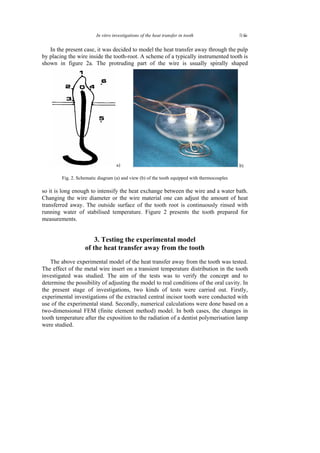 Heat transfer in human tooth | PDF