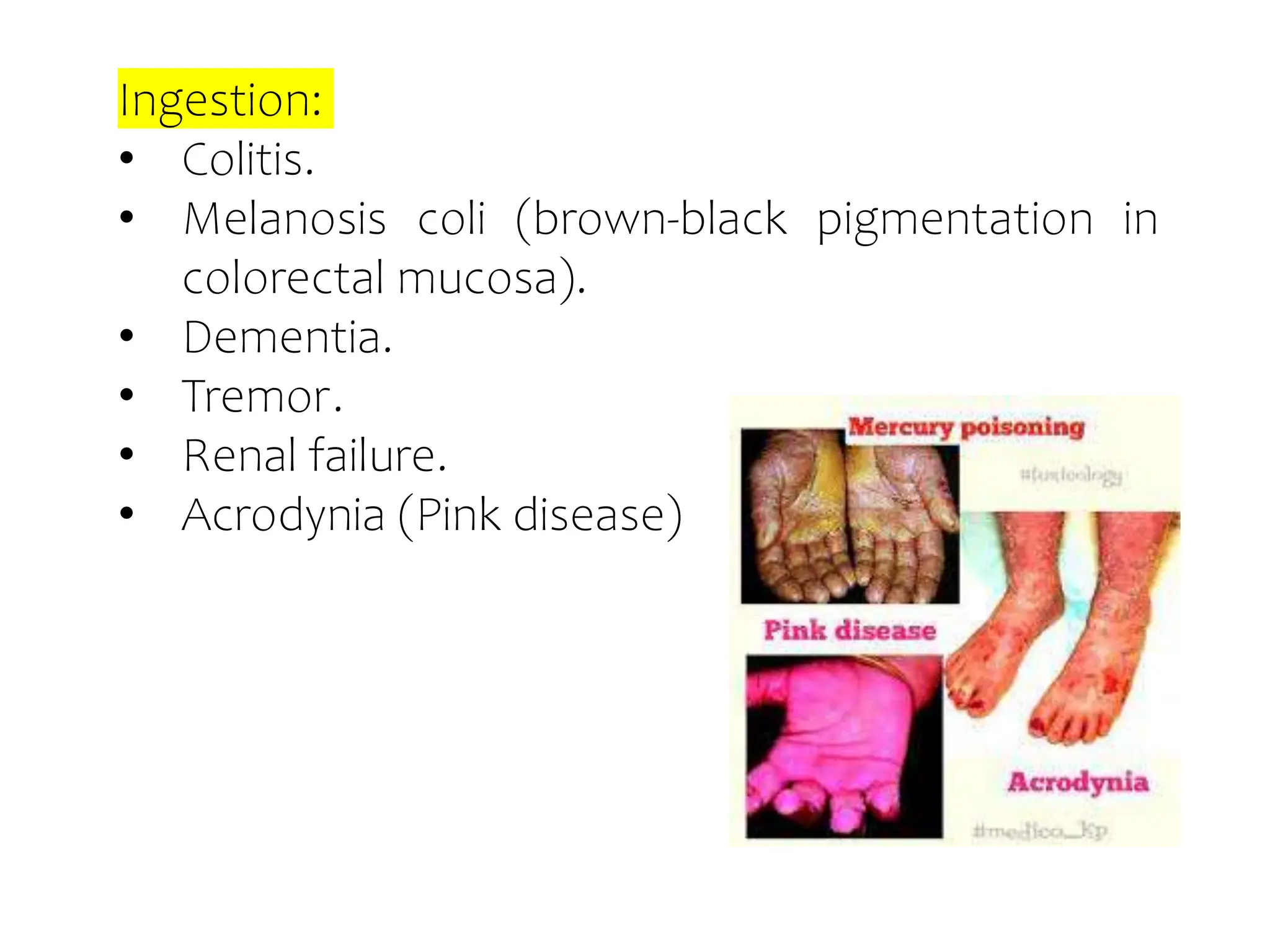 clinical features and management of heavy metal poisoning .pptx