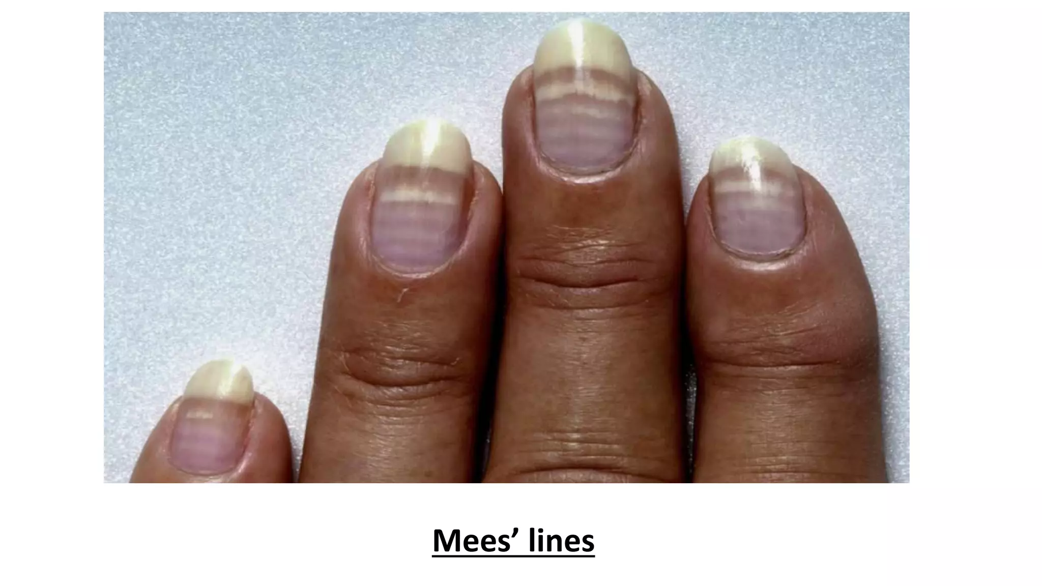 Heavy metal poisoning PPT.pptx