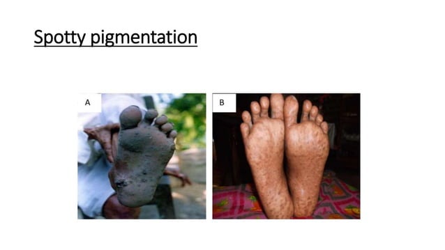Heavy metal poisoning PPT.pptx