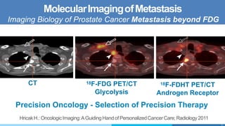 Radiomics in Oncology | PPTX