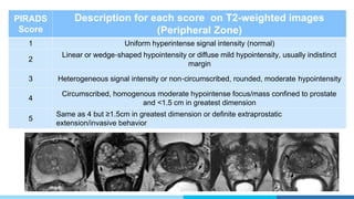 Radiomics in Oncology | PPT