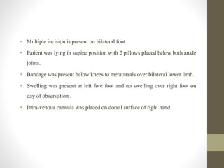 Calcaneus fracture of bilateral feet: Examination, Investigation ...