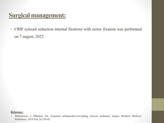 Calcaneus fracture of bilateral feet: Examination, Investigation ...
