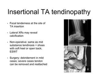 Heel pain - Derek Park | PPTX