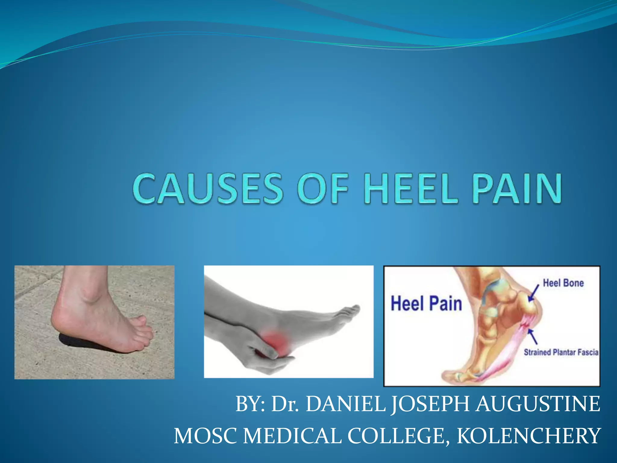 Heel pain and plantar fasciitis | PPTX