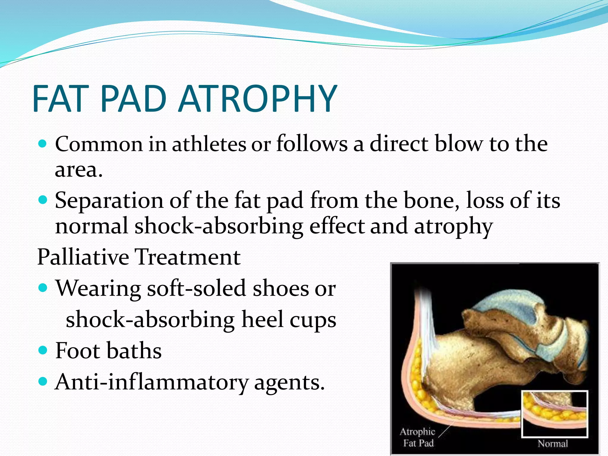 Heel pain and plantar fasciitis | PPTX
