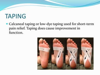 Heel pain and plantar fasciitis | PPTX