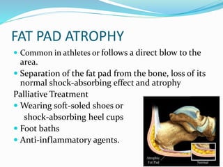 Heel pain and plantar fasciitis | PPTX