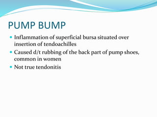 Heel pain and plantar fasciitis | PPTX