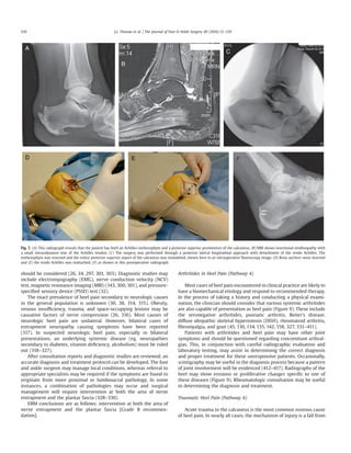 Heel Pain and Plantar Fasciitis | PDF