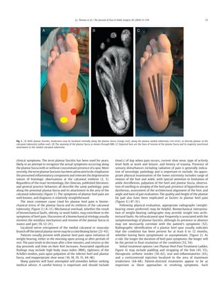 Heel Pain and Plantar Fasciitis | PDF