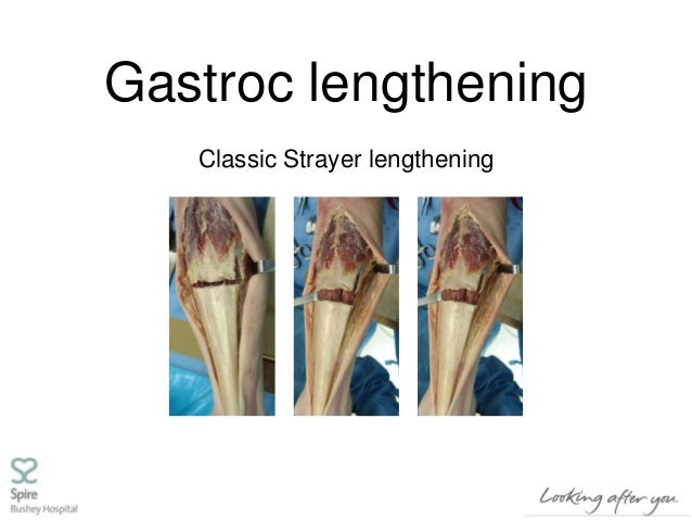 Heel pain Spire Bushey