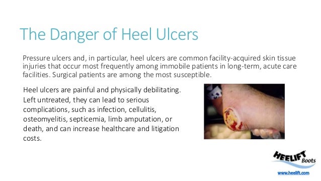 Heel Pressure Ulcer Prevention