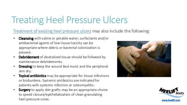 Heel Pressure Ulcer Prevention