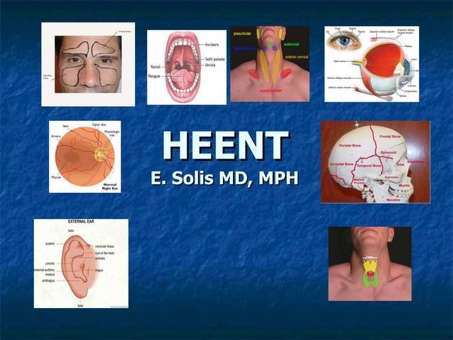 Heent | PPT | Thyroid Disorders | Endocrine and Metabolic Diseases