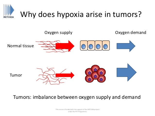 Tumour Hypoxia - detection and prognostic significance