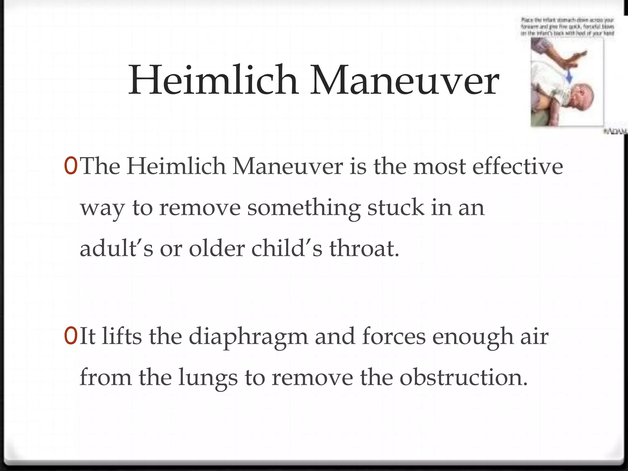 Heimlichs manuever | PPTX