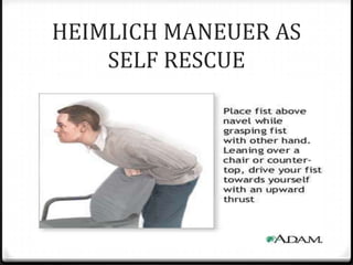 Heimlichs manuever | PPTX