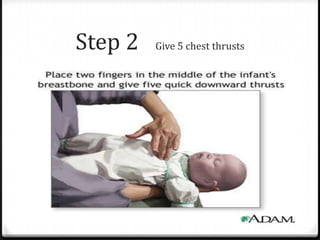Abdominal Thrusts Steps