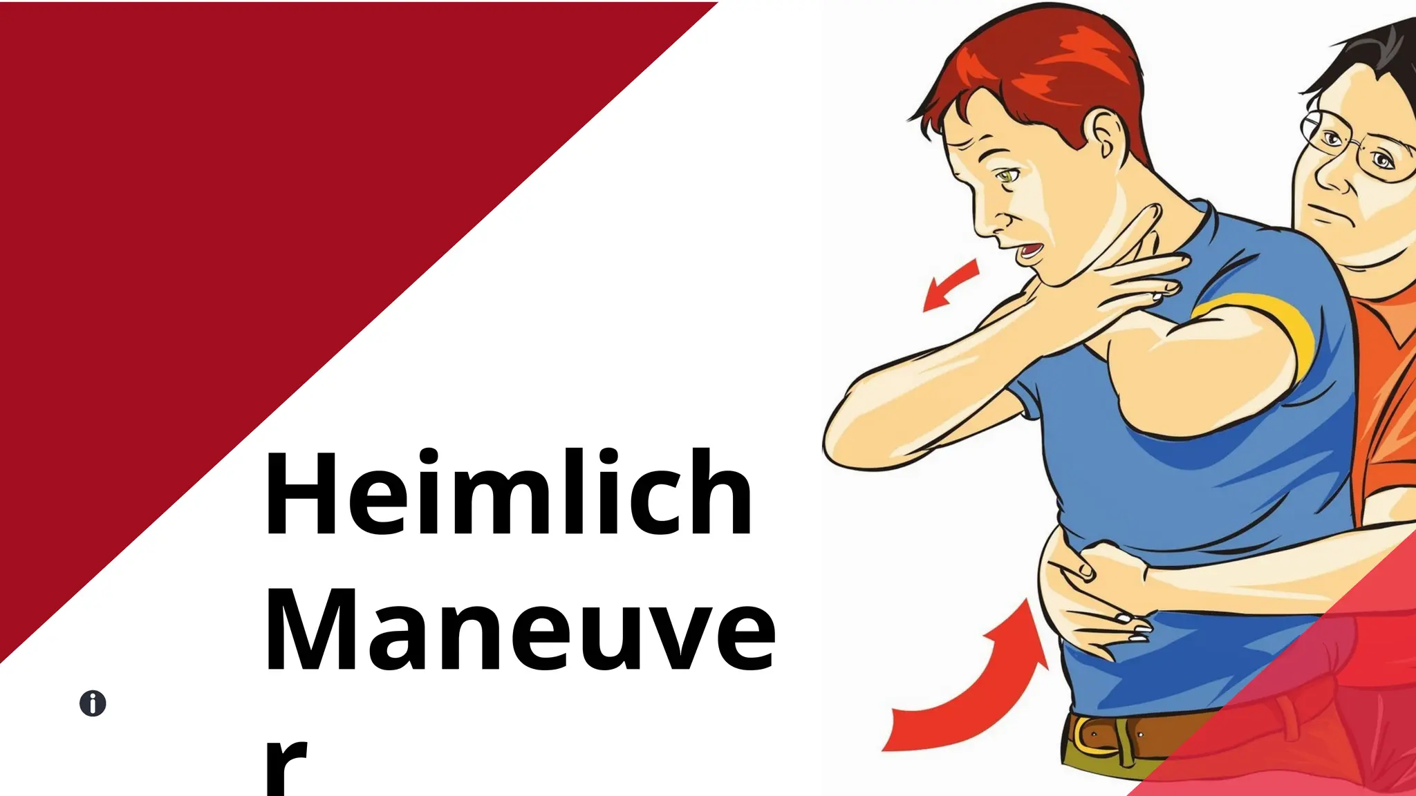 heimlich maneuver- technique for choking incidents | PPTX