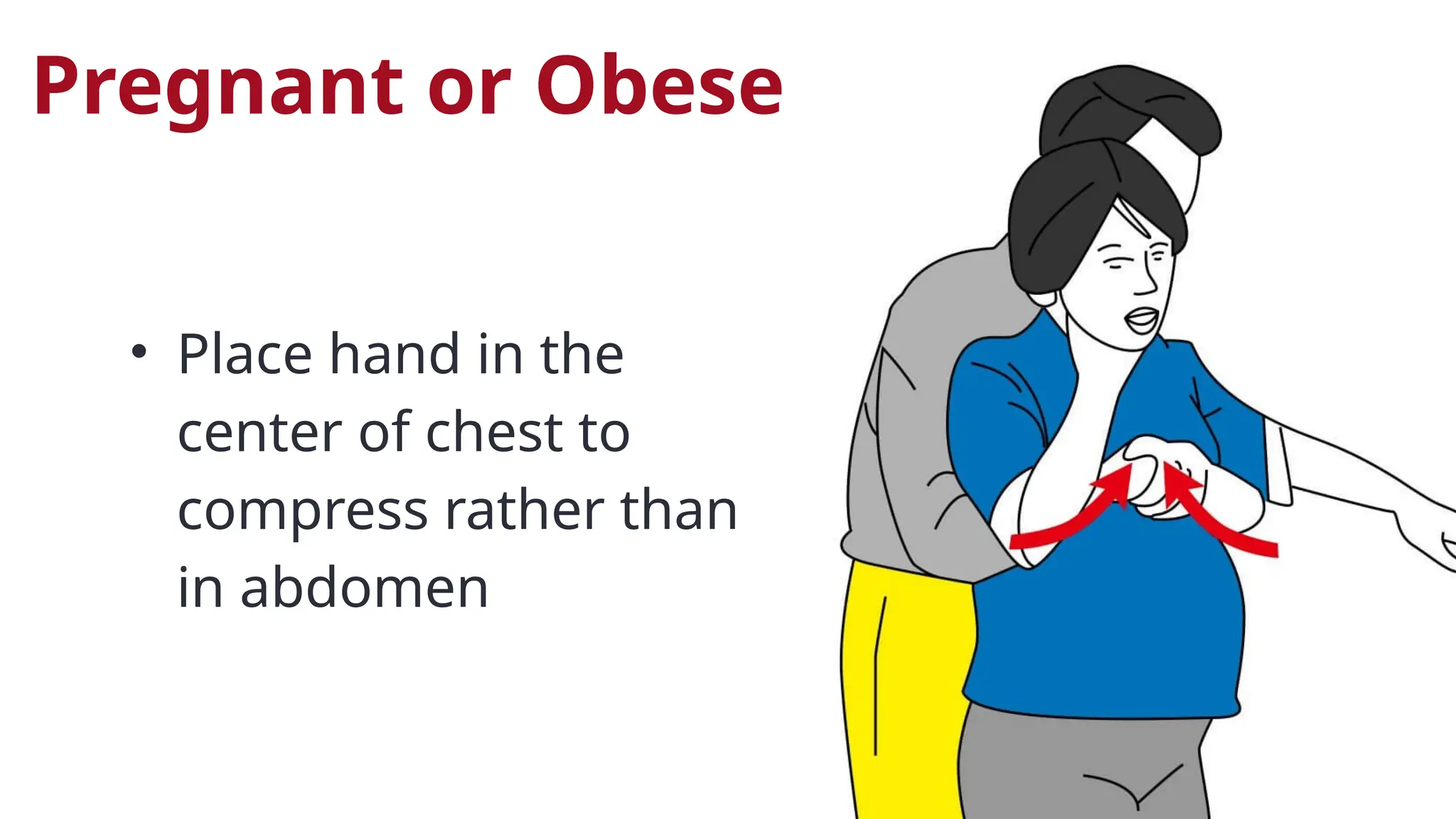 heimlich maneuver- technique for choking incidents | PPTX