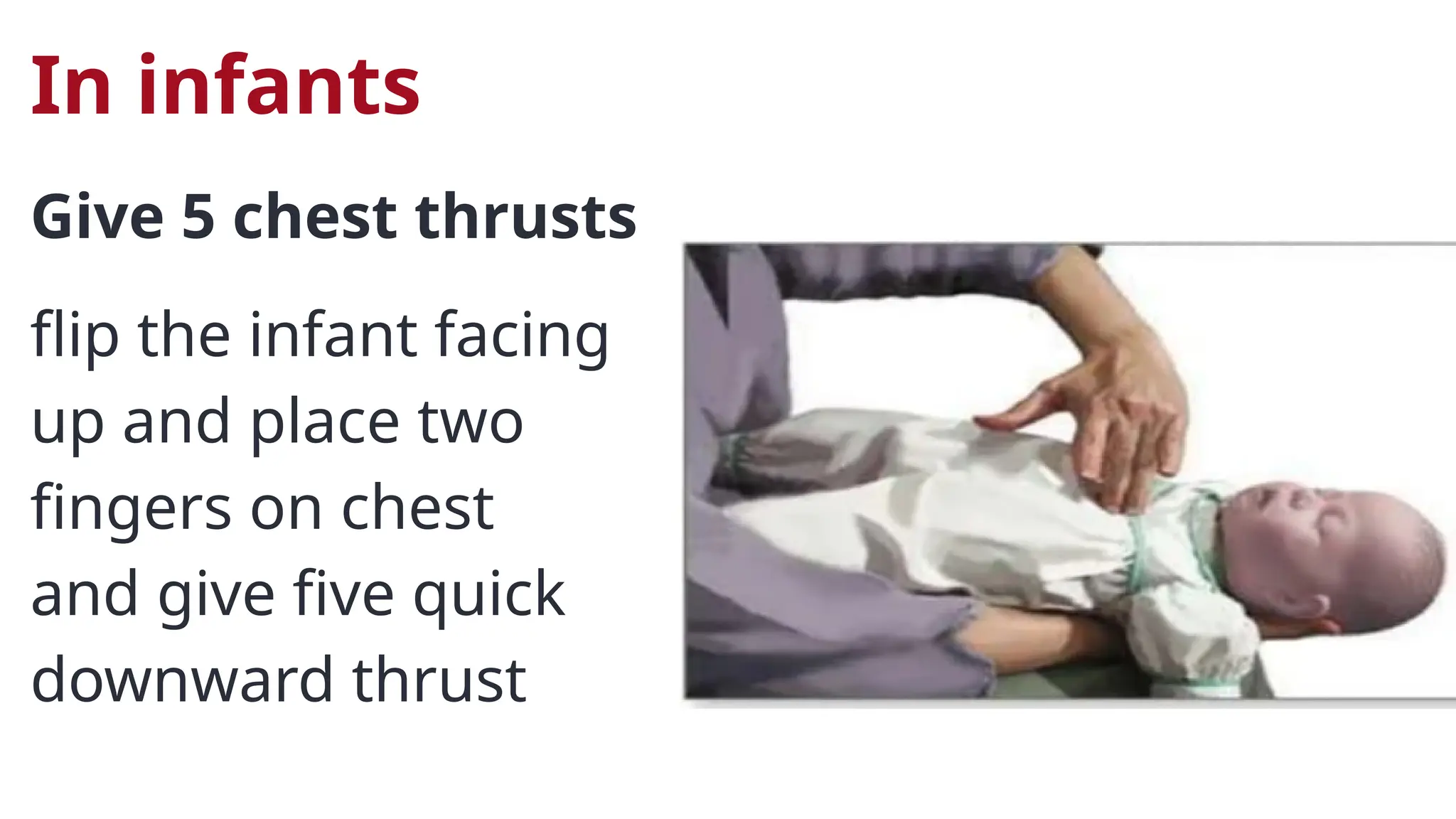 heimlich maneuver- technique for choking incidents | PPTX