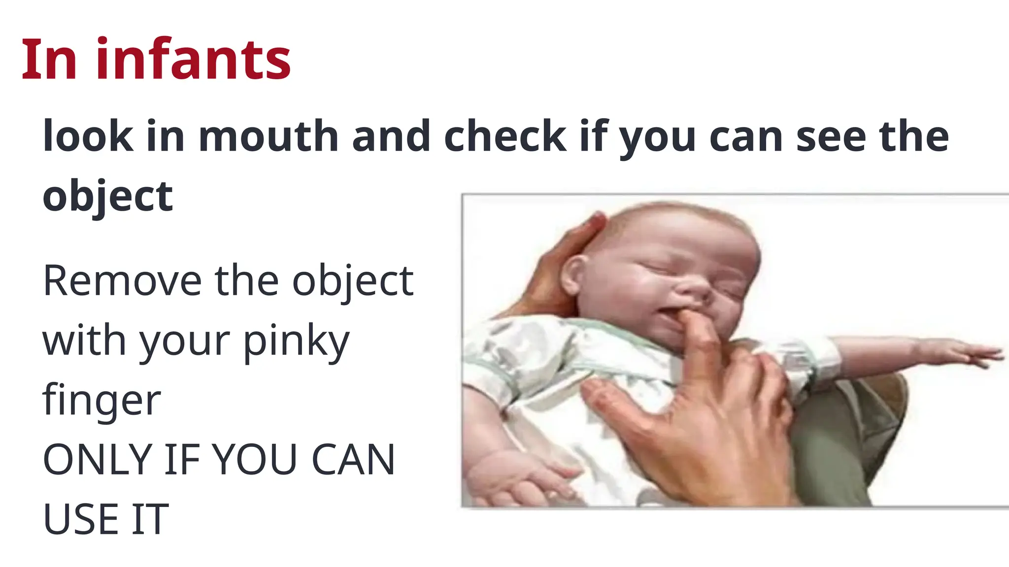 heimlich maneuver- technique for choking incidents | PPTX