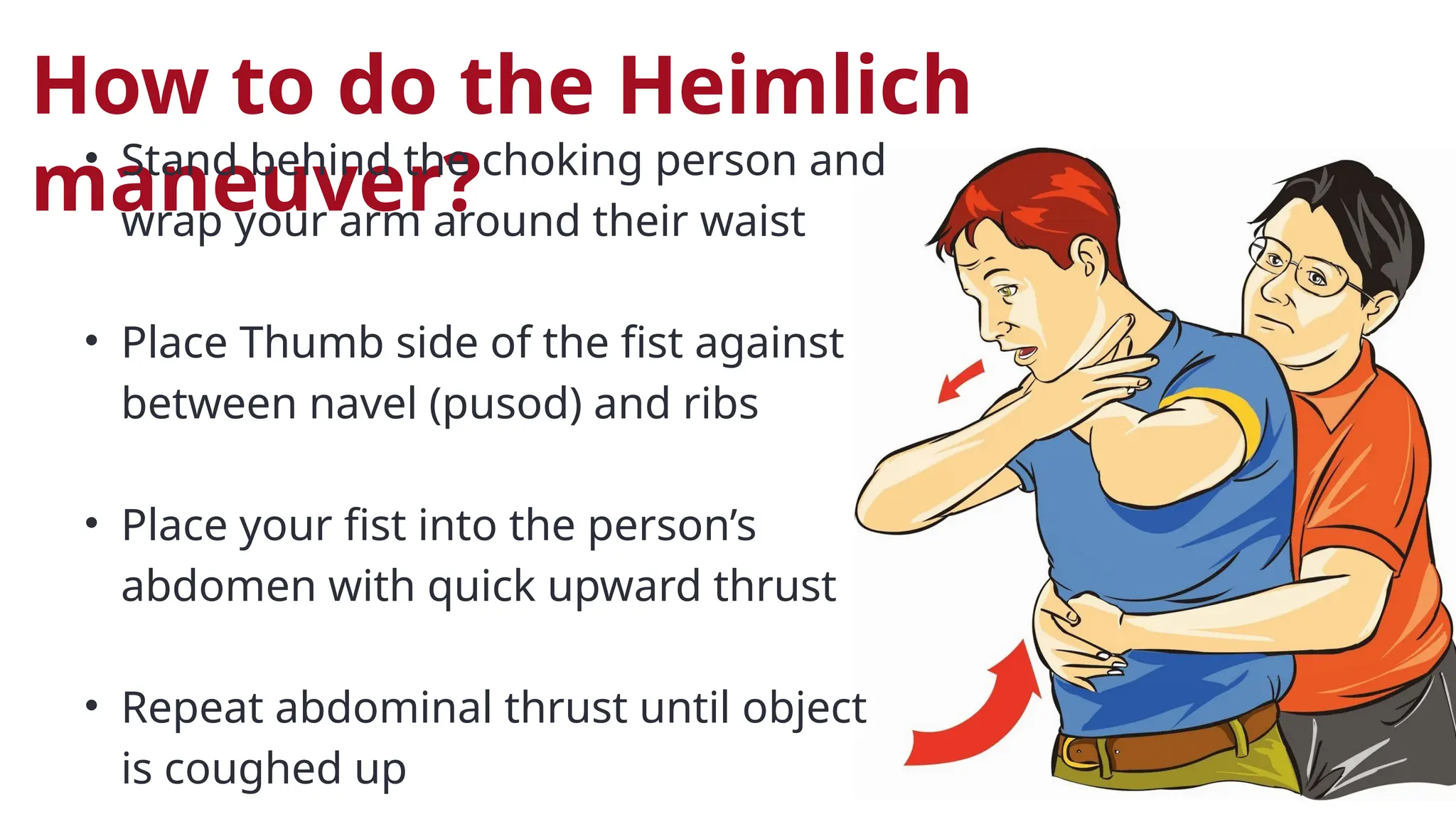heimlich maneuver- technique for choking incidents | PPTX