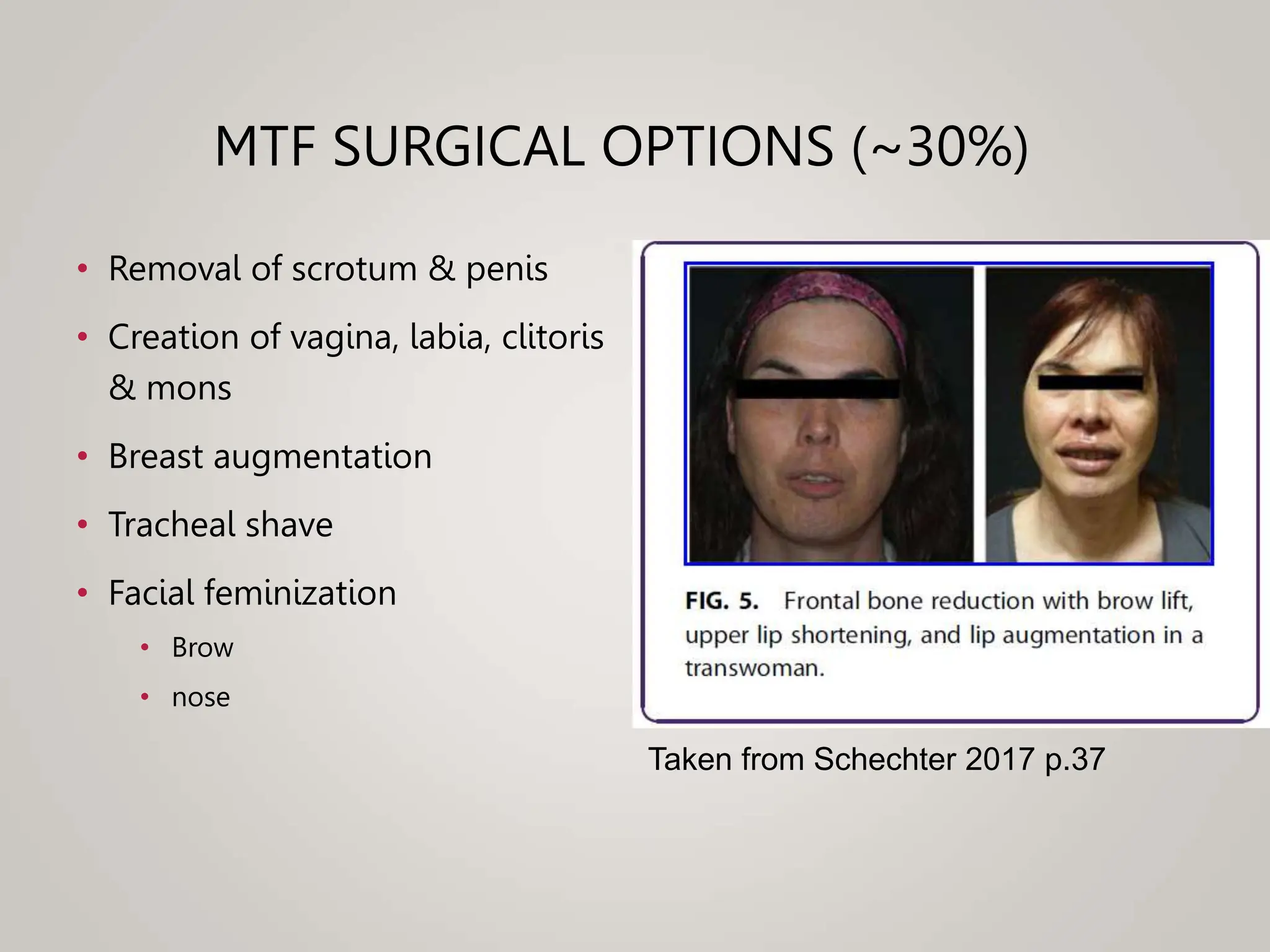 LGBTQ Health: Diversity and Inclusion all | PPT